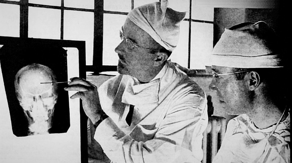 Otec lobotomie Walter Freeman bral lidem duše i životy – Světoběžník.info